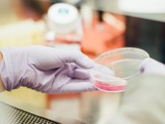 Associate Medical Technologist (Histopathology Laboratory) - 职位空缺 ...